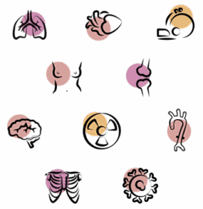 Why Incepto? - Incepto medical